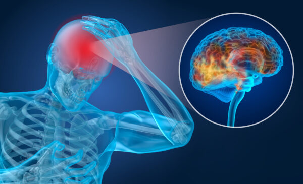 How to Know if You Have a Traumatic Brain Injury After an Accident ...